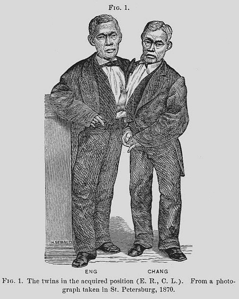 Report of an autopsy on the bodies of Chang and Eng Bunker, commonly known as the Siamese twins ...